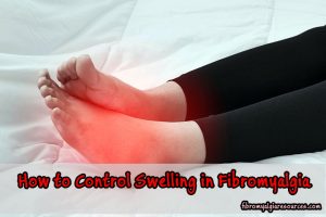 How to Control Swelling in Fibromyalgia - Fibromyalgia Resources